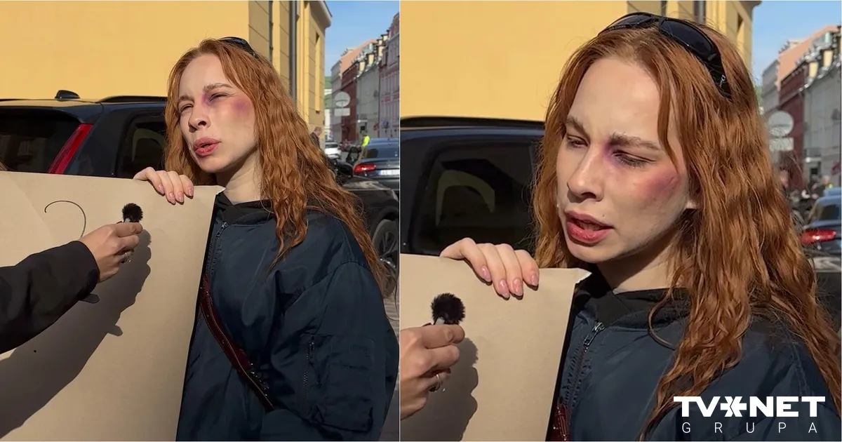 VIDEO Aktrise Linarte: "Mēs dzīvojam sabiedrībā, kur nonstopā ...