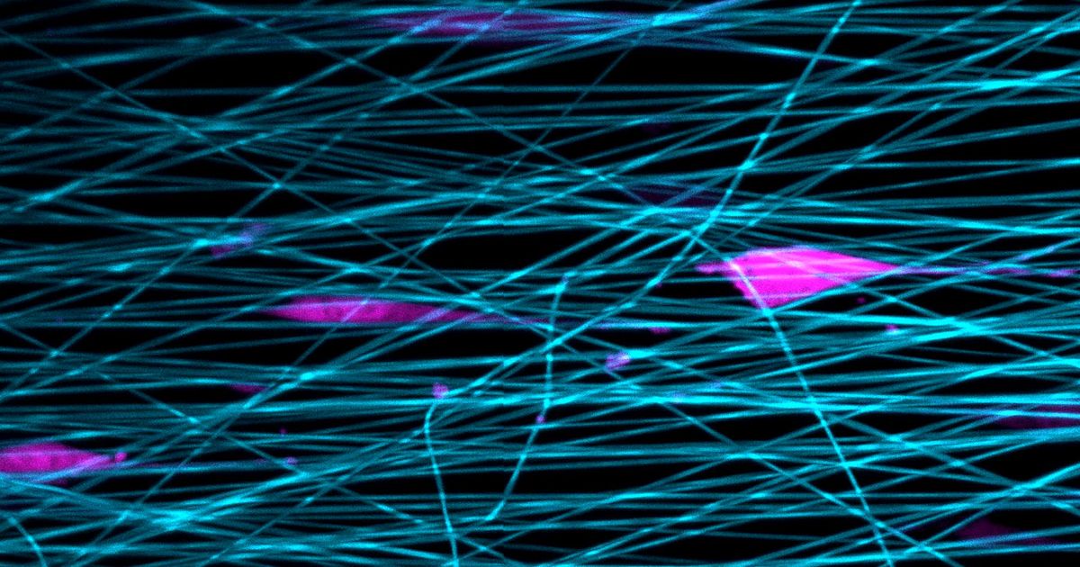 Vaata: teadlased tabasid videosse, kuidas inimese rakud kehas ...